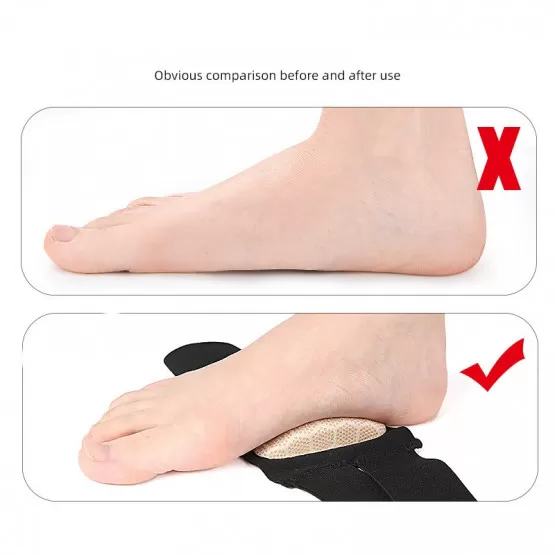 INF Adjustable Bandage Arch Support Foot Pads - Orthopedic Insoles for